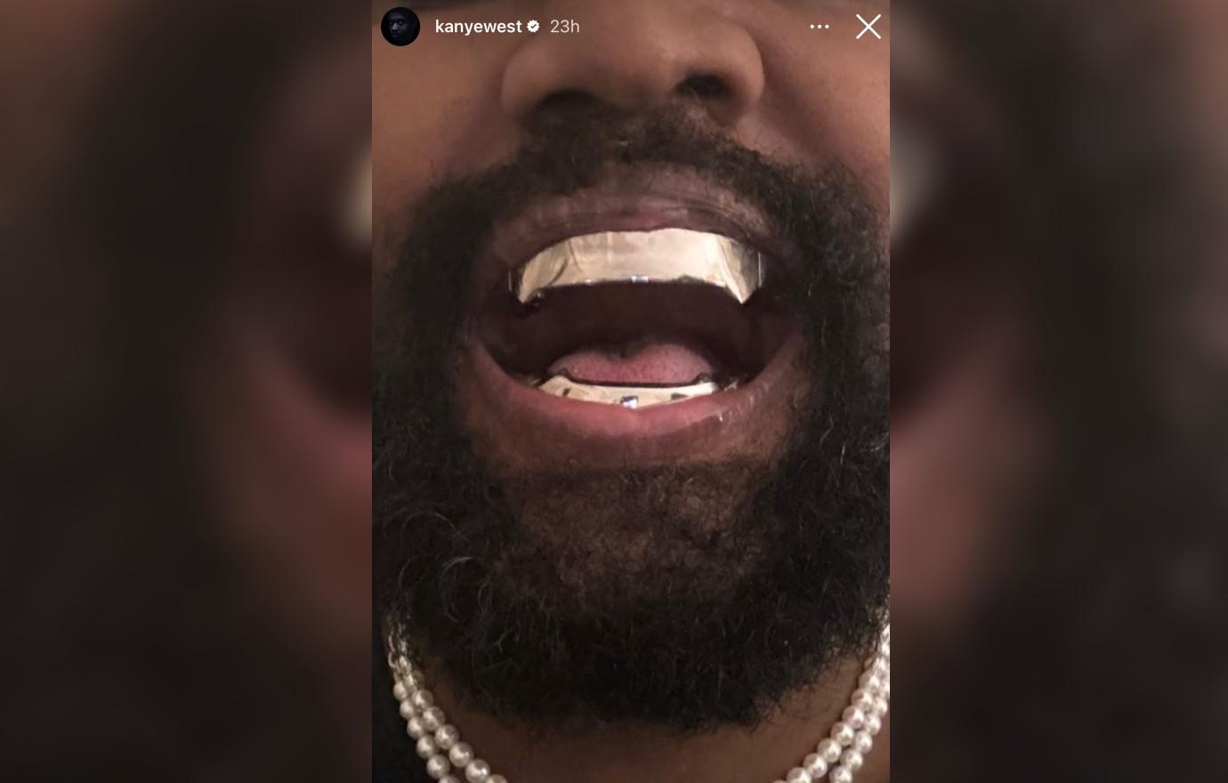 North & Kanye West Debut New Expensive Mouth Pieces: Photos