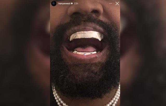 North & Kanye West Debut New Expensive Mouth Pieces: Photos