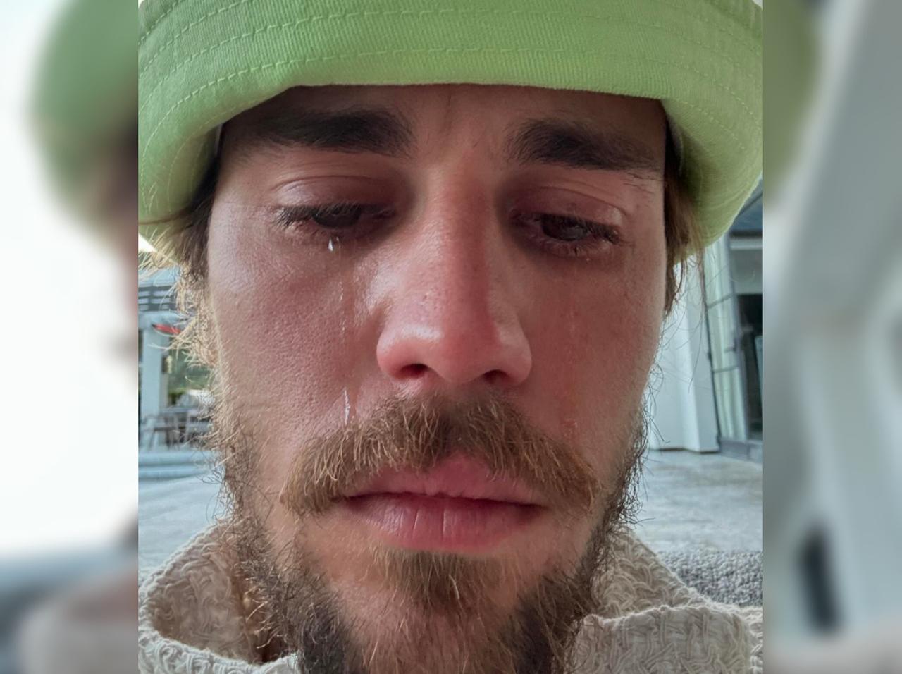 Justin Bieber Going Through A 'Hard Time' As Fans Remain Concerned