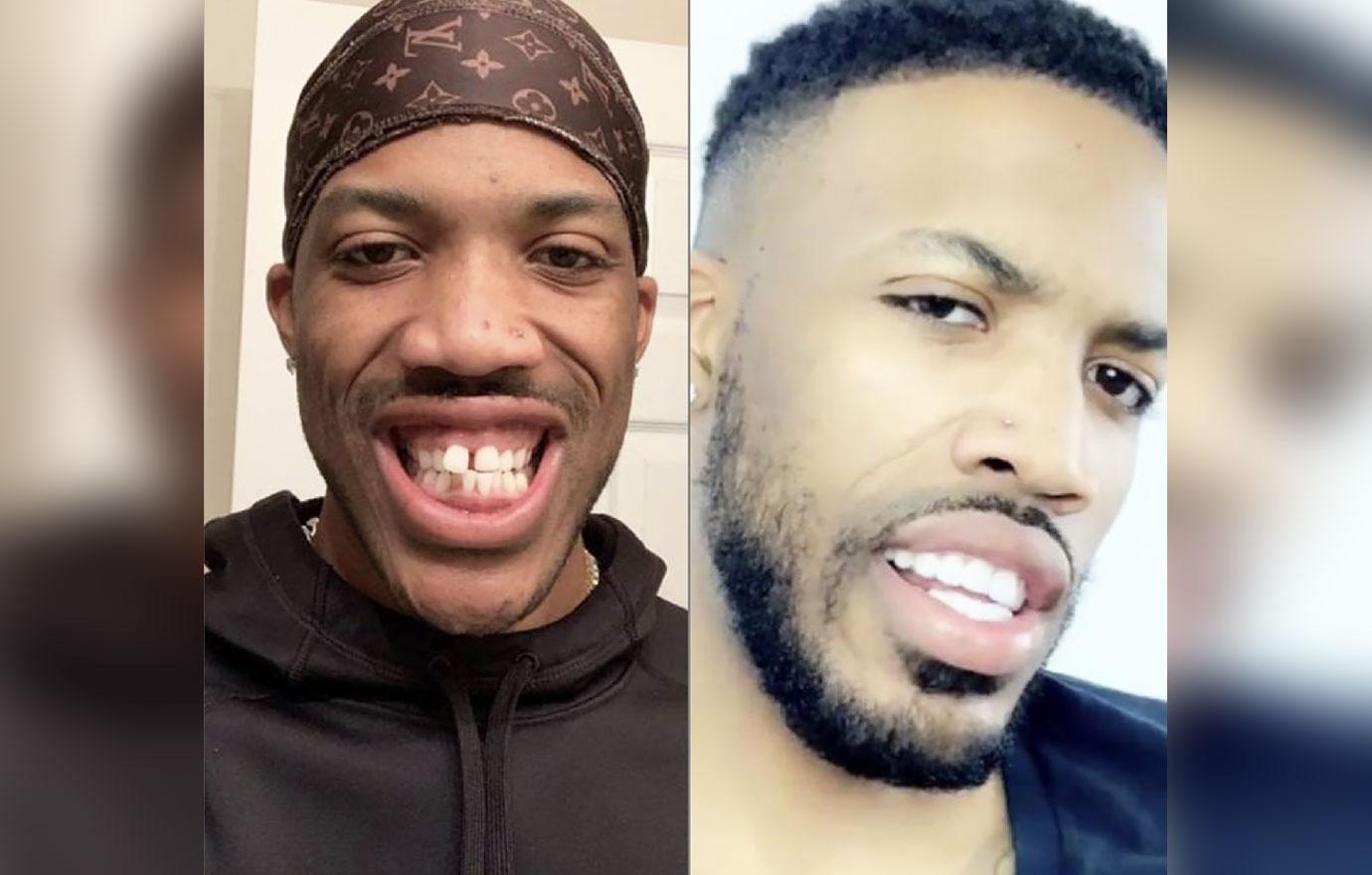 Get $369 OFF Byte Aligners For A Straighter, Whiter Smile