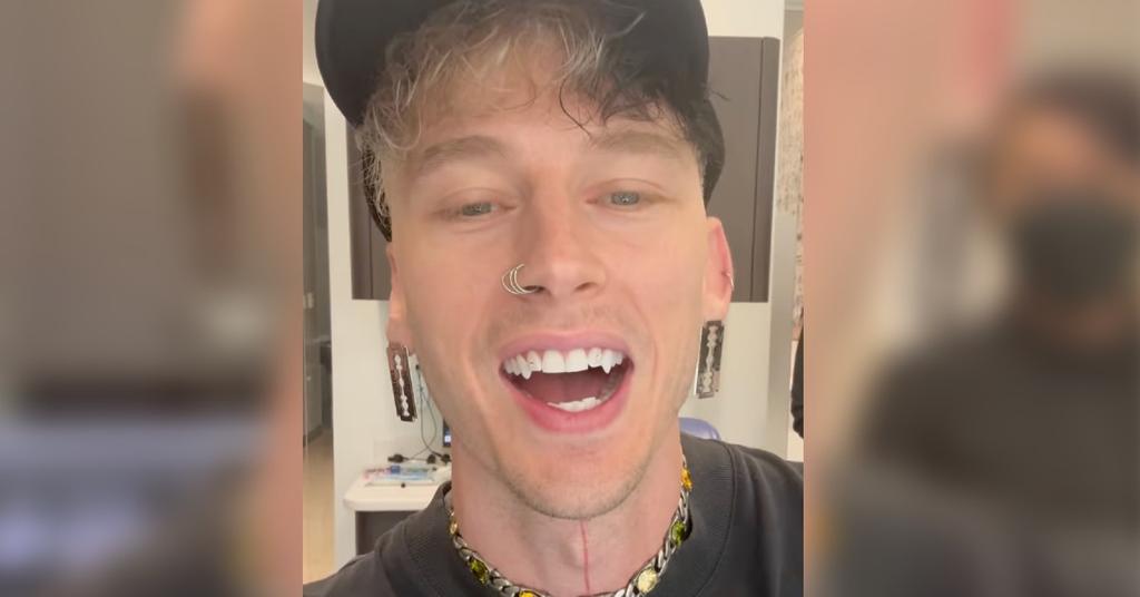 Machine Gun Kelly Divides Fans As He Shows Off New Teeth In Bold Look