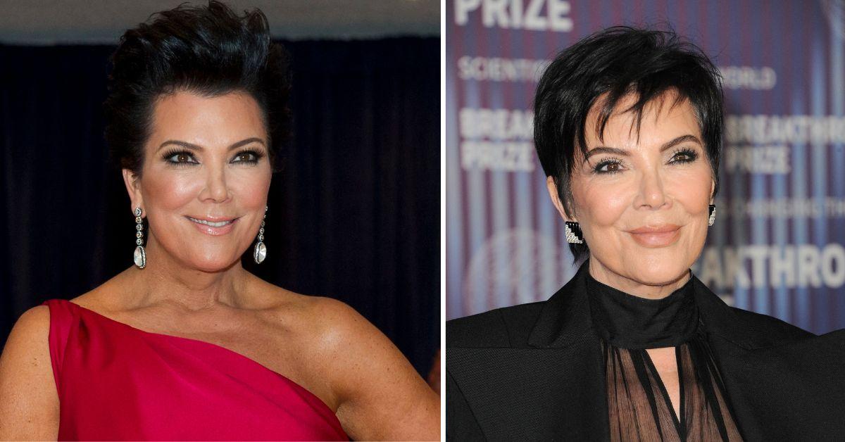 Kris Jenner Is ‘Crazy About Laser Skincare’ After Unveiling New Face