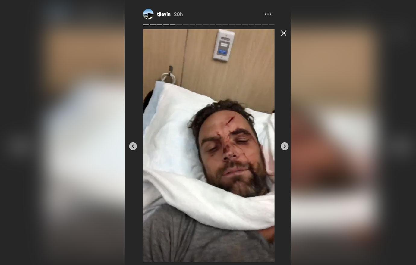 'The Challenge' Host TJ Lavin Seriously Injured in BMX Accident in Vegas