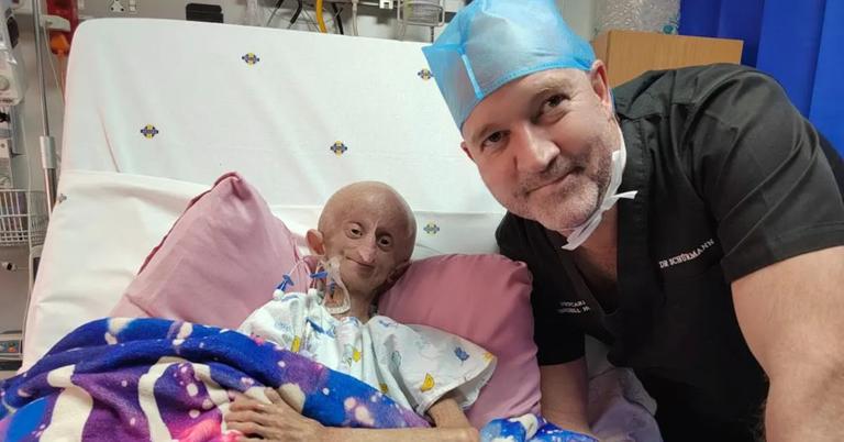 TikTok Star Beandri Booysen Dead At 19 Due To Rare Aging Disease