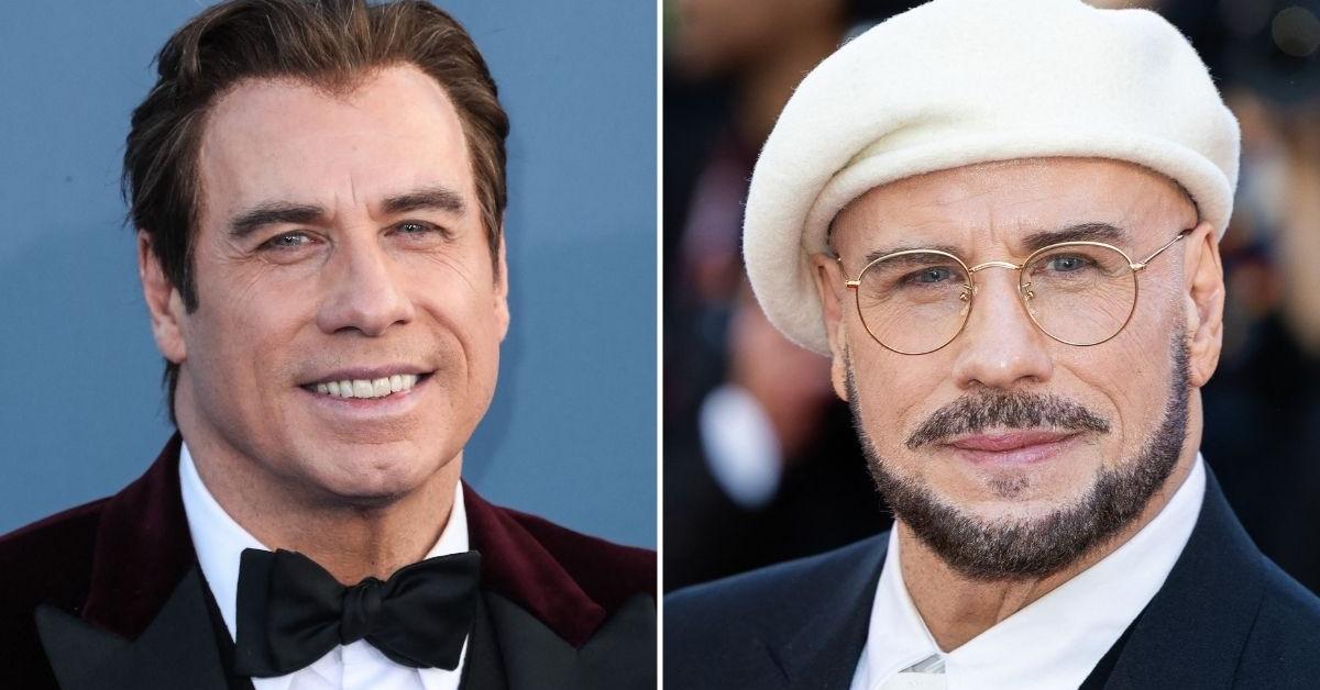 John Travolta’s New Appearance May Be The Result Of A Facelift: Expert