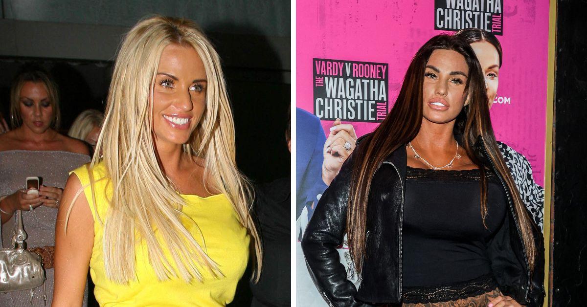 Celebrities Who Had The Craziest Plastic Surgeries