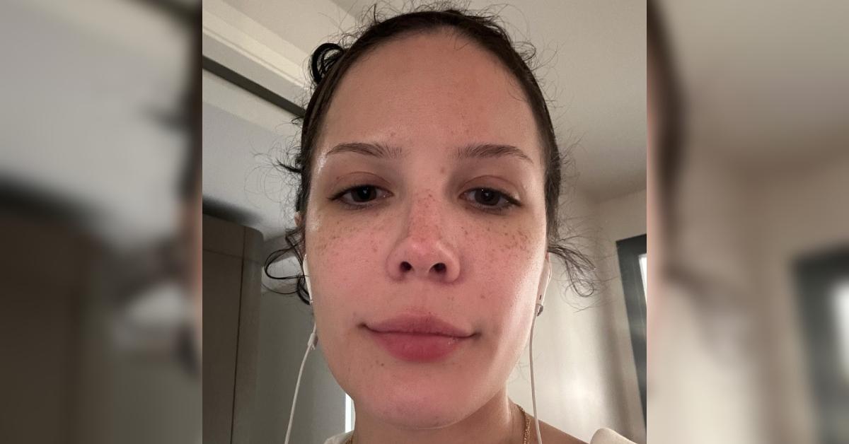 Halsey Shows Off Medical Port In Pantsless Photo Amid Health Woes