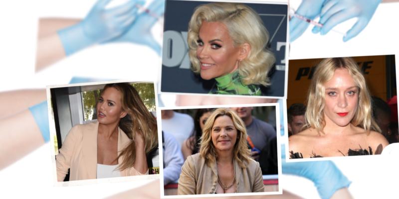 15 Celebrities Who Admitted To Loving Botox Injections: Kelly Ripa & More