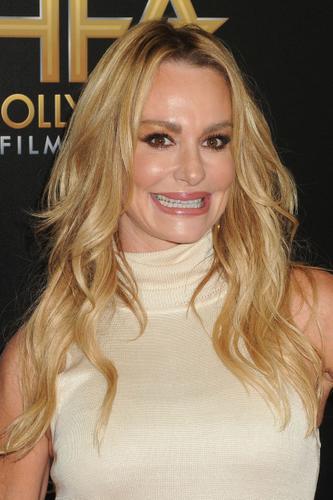 Taylor Armstrong’s Face Looks ‘Unnatural’ & ‘Abnormal’ According To ...