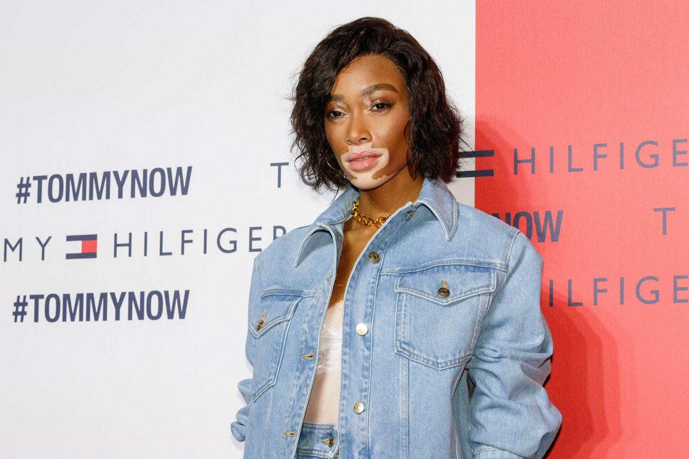 Winnie Harlow Clarifies Her 'America's Next Top Model' Comments