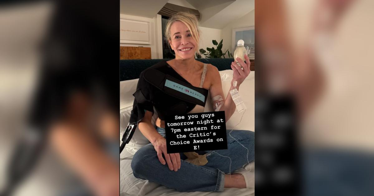 What's On Chelsea Handler's Arm? Host Wears Bandage To Critics' Choice