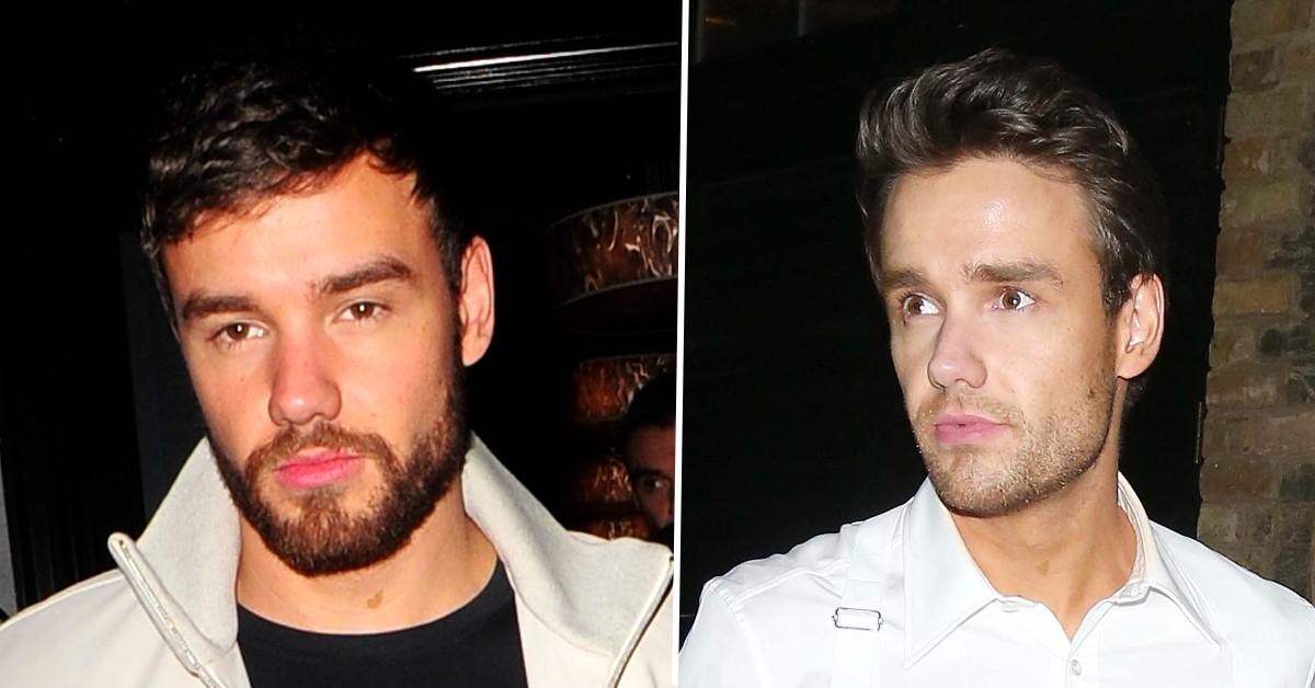 Liam Payne Causes Concern After Looking Unrecognizable