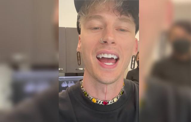 Machine Gun Kelly Divides Fans As He Shows Off New Teeth In Bold Look