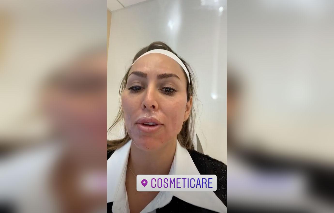 Kelly Dodd Shows Off Results Of Chemical Peel & 'Mini Facelift'