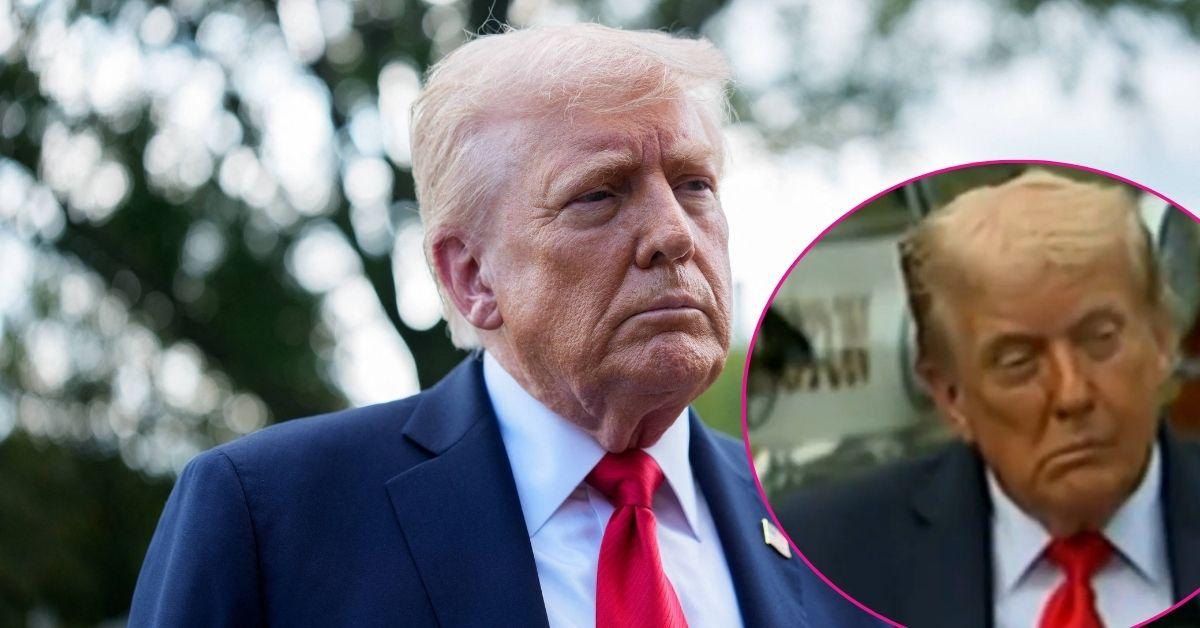 Donald Trump's 'Droopy' Face Convinces Critics He Suffered A Stroke