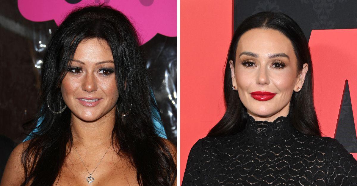 'Jersey Shore' Cast: Who Has Had Plastic Surgery?