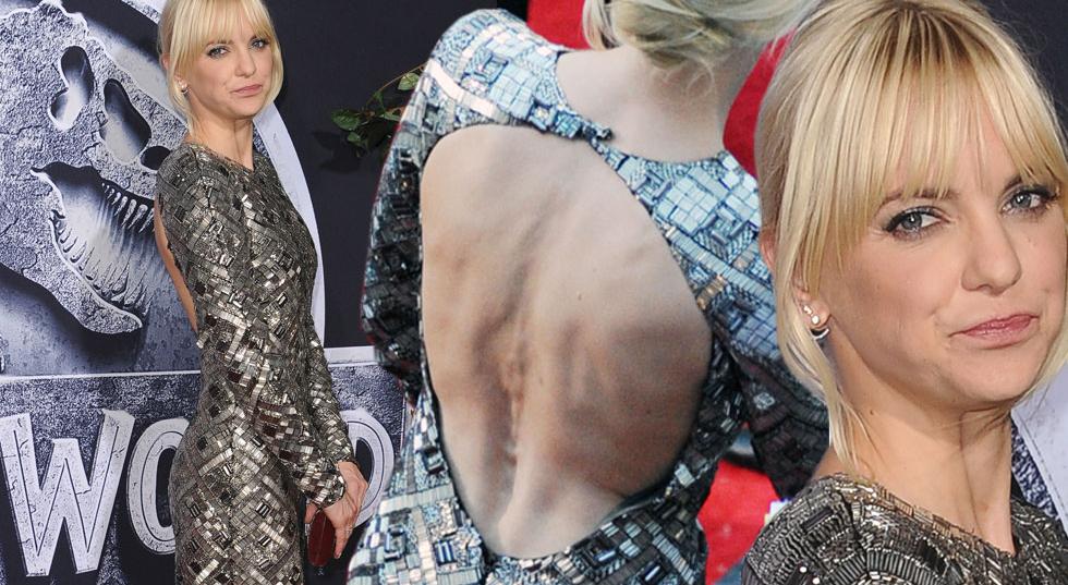 Scary Skinny: Anna Faris Is Stressed Out And Wasting Away