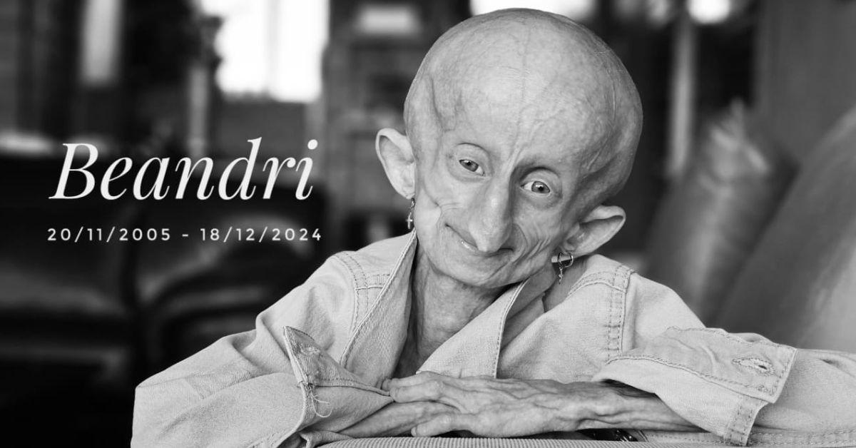 TikTok Star Beandri Booysen Dead At 19 Due To Rare Aging Disease