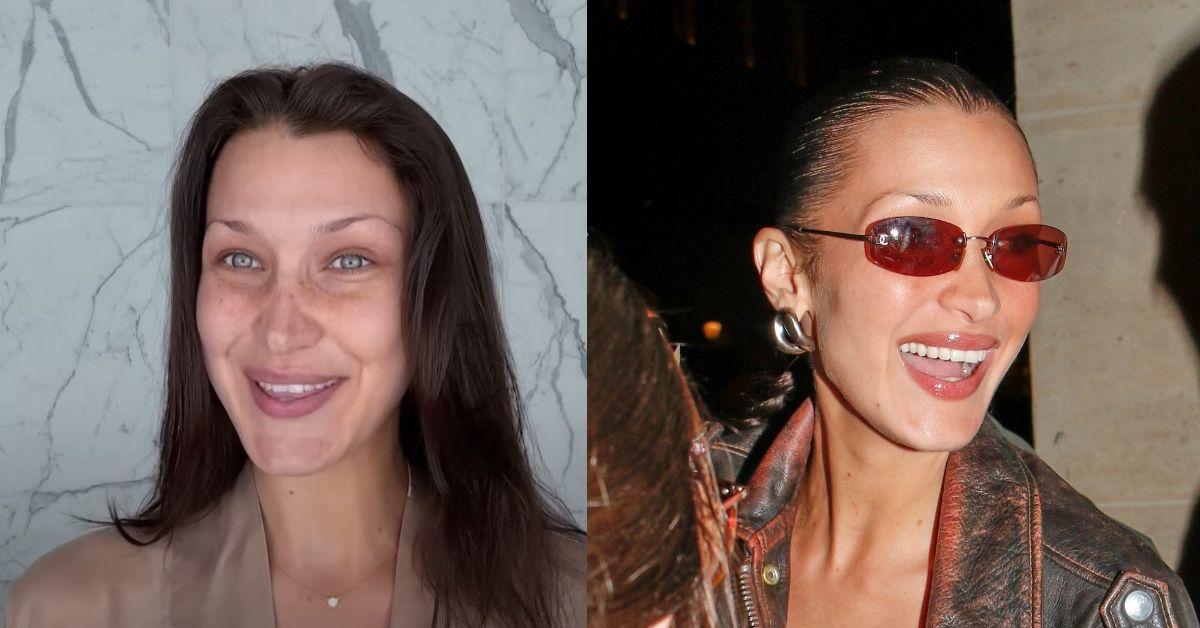 Bella Hadid Stops Plastic Surgery Speculation With Face Tape Reveal