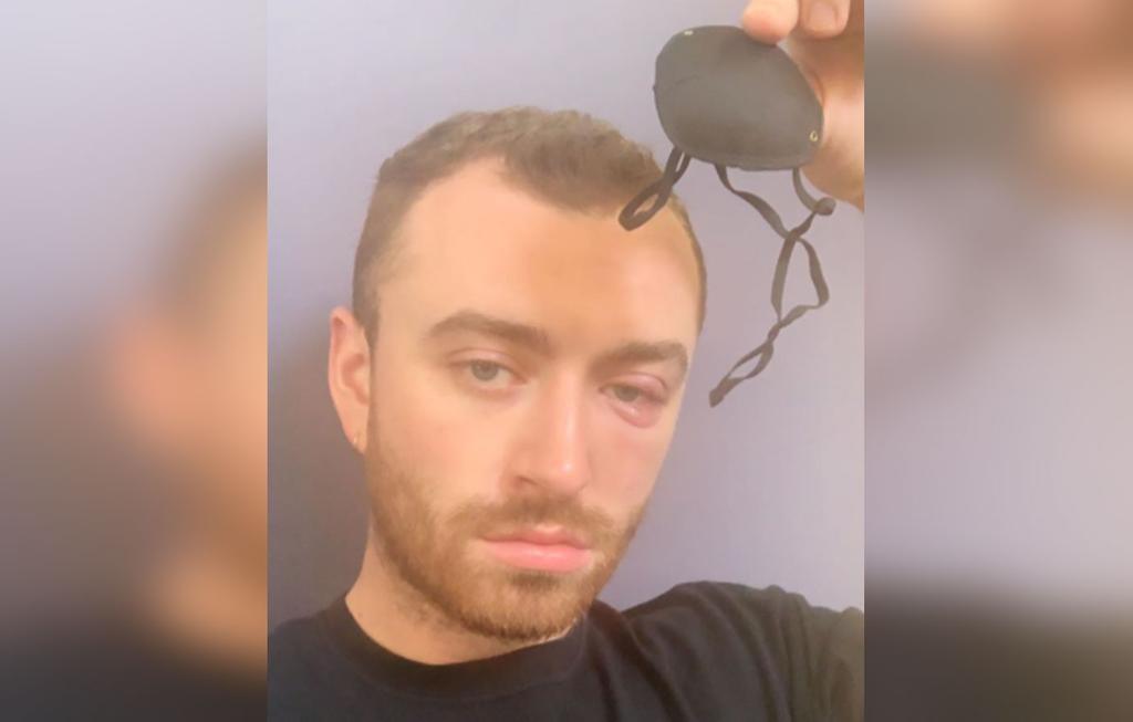 Sam Smith Undergoes Eye Surgery! Get All The Details Here