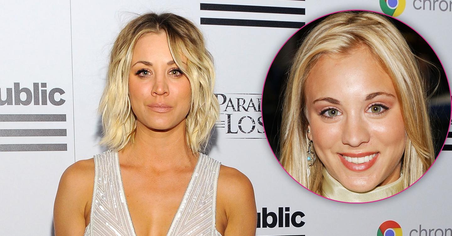 Nose Job, Boob Job & More! Kaley Cuoco Confesses She's Had Multiple ...