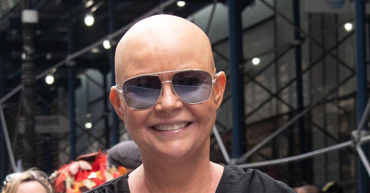 14 Celebrities Who Battle Hair Loss: Gail Porter, Lea Michele & More