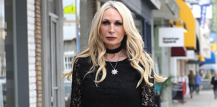 'RHONJ' Villain Kim D Begs 'Botched' Doctors To Fix Her Bad Boob Job