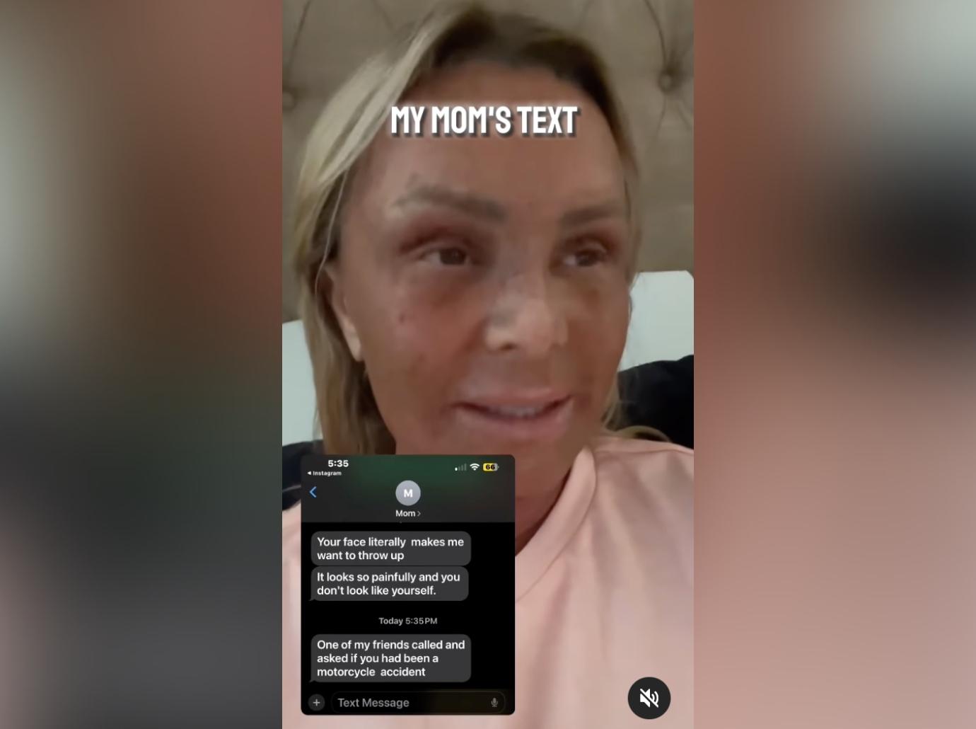 Tamra Judge's Mom Disses Her Face After Plastic Surgery: Photos