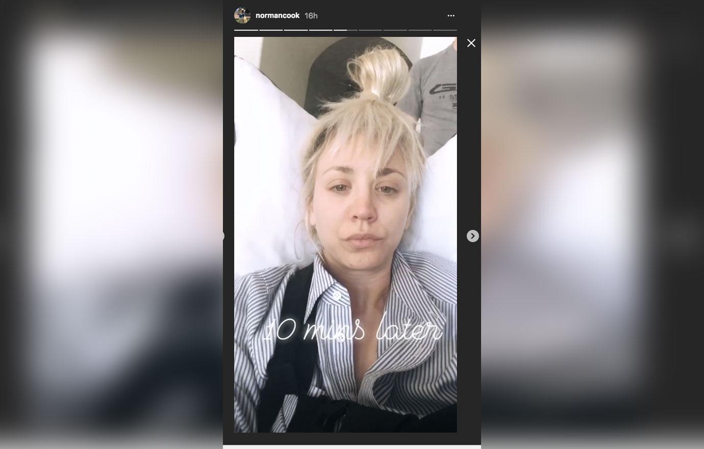 Kaley Cuoco Had Shoulder Surgery Five Days After Getting Married