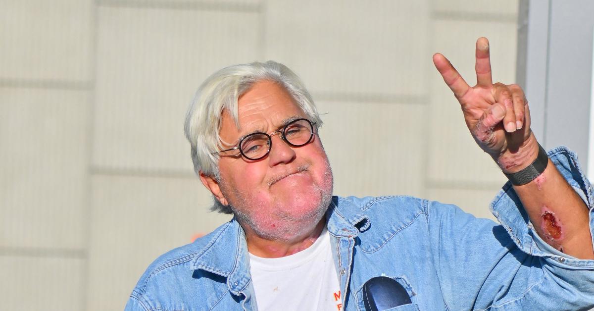 Jay Leno Jokes About His 'New Face' After Being Burned In Fire