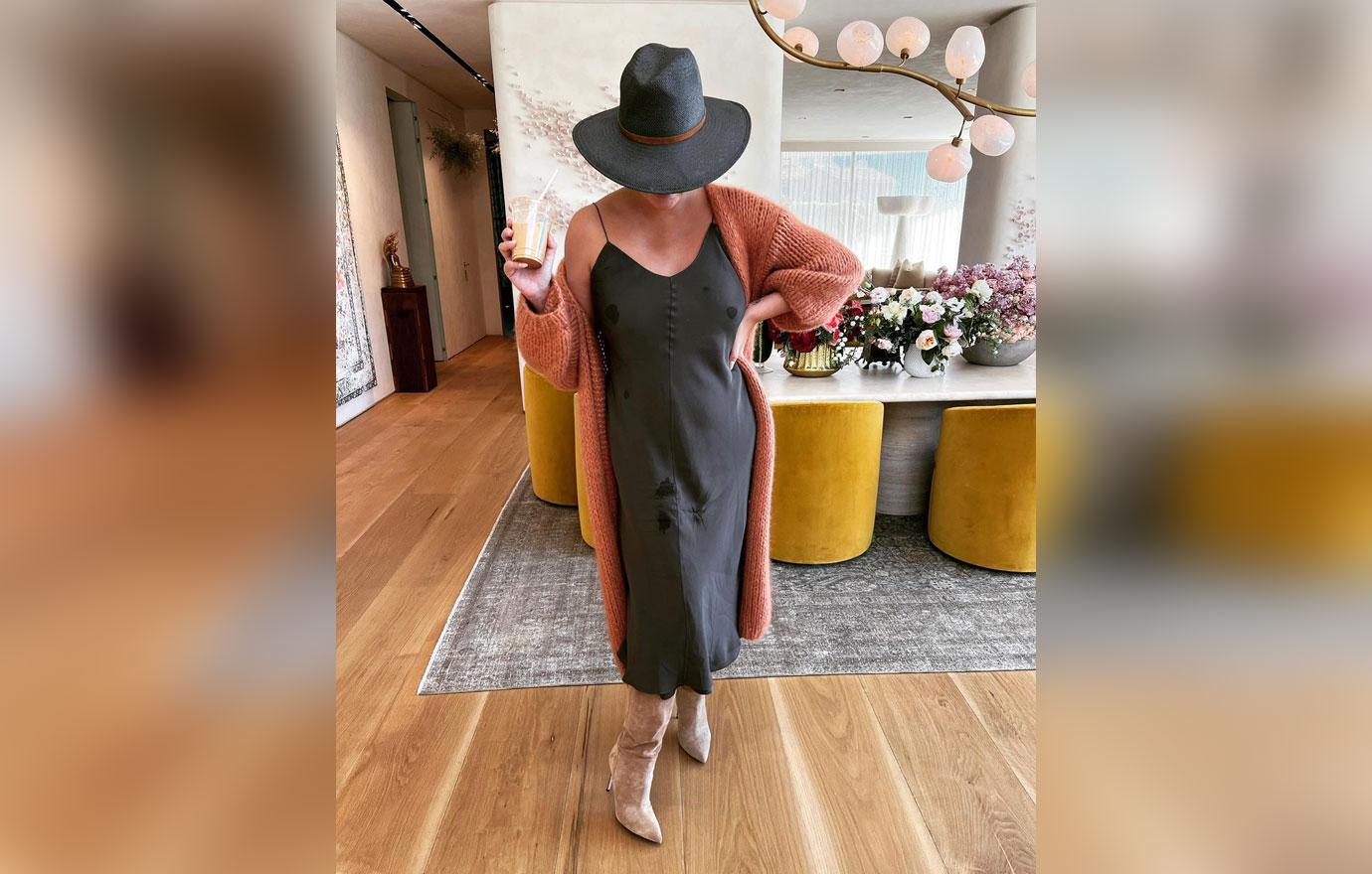Chrissy Teigen Has To 'Bandage' Wound After Welcoming Daughter Esti