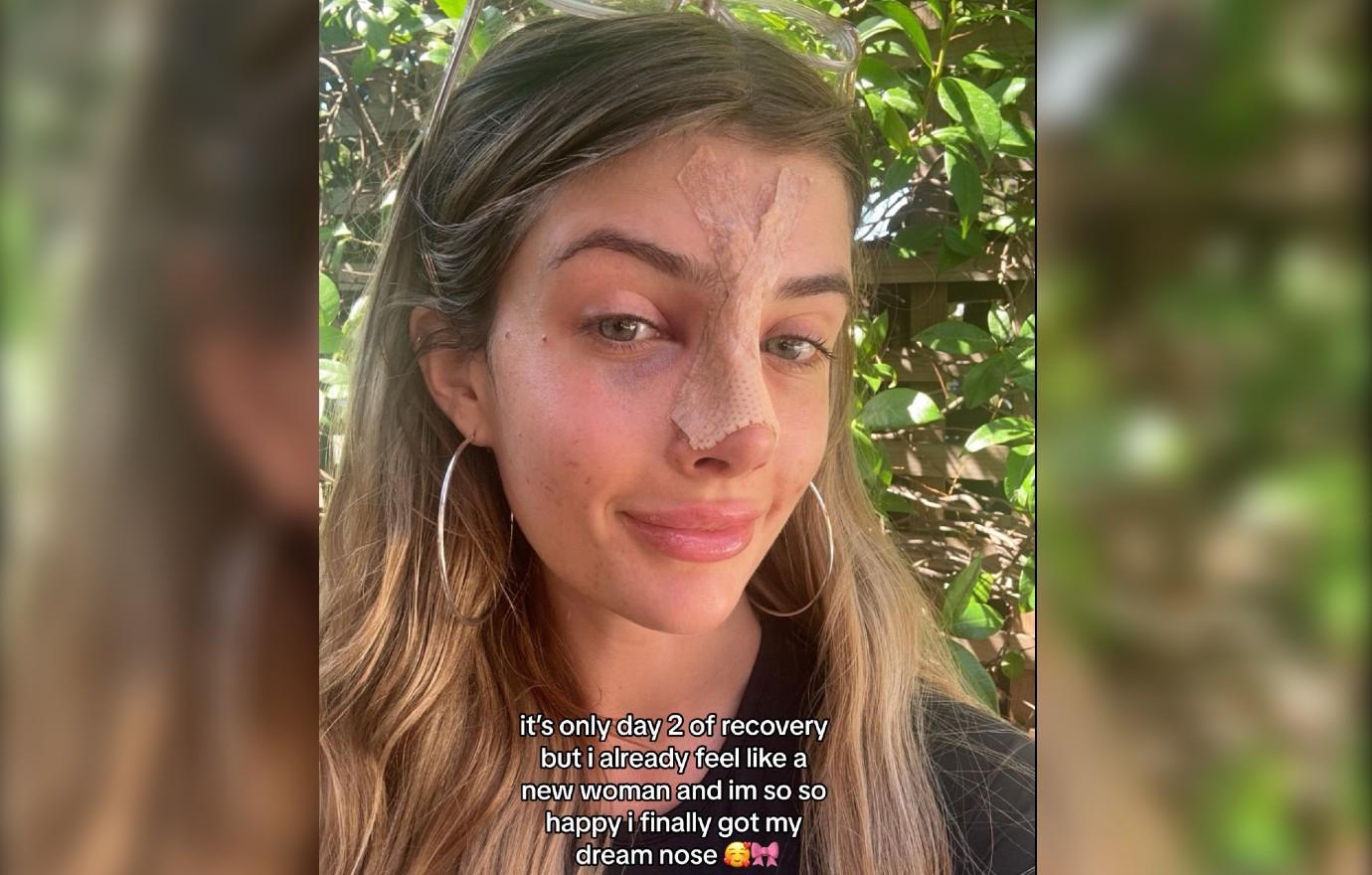 Sami Sheen Gets Nose Job After Breast Implants: Watch