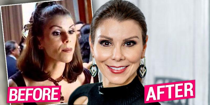 ‘RHOC’: Heather Dubrow Claims She’s Had No Facial Plastic Surgery