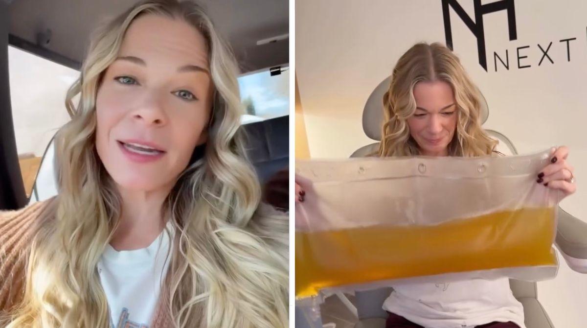 LeAnn Rimes Skips Filming To Get Blood Plasma Replacement Procedure