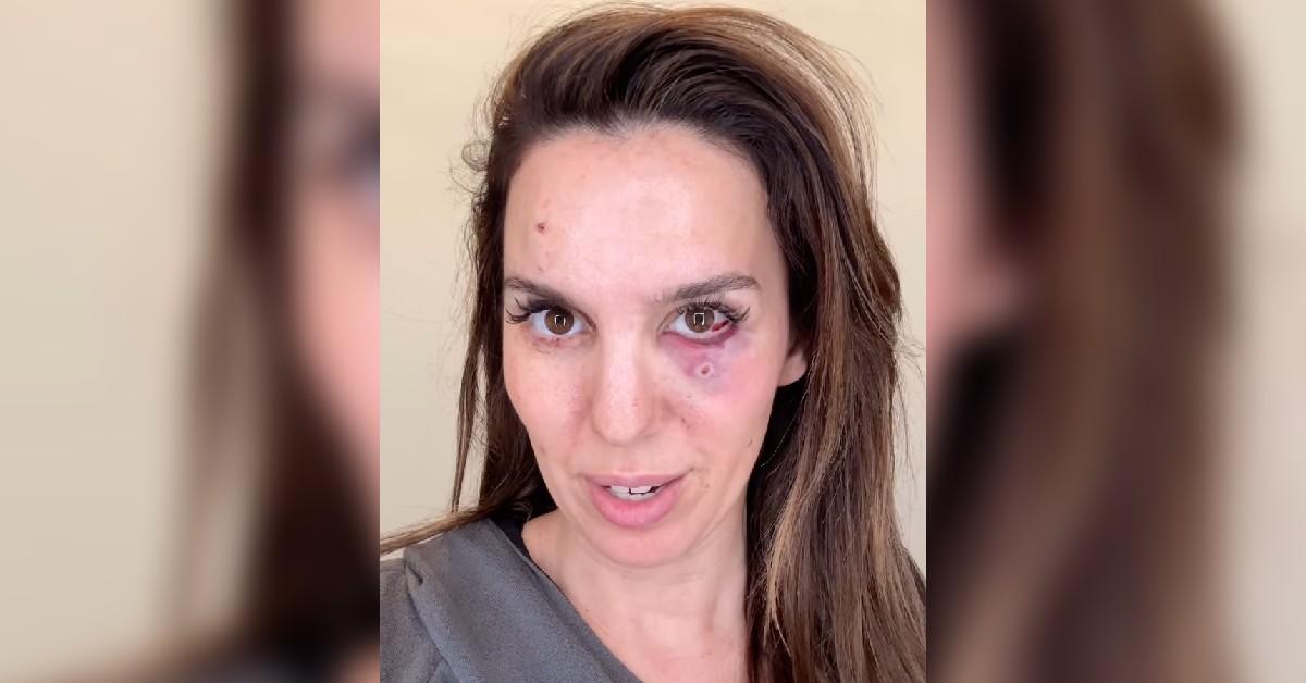 Christy Carlson Romano Reveals She Was Shot During Accident: Watch