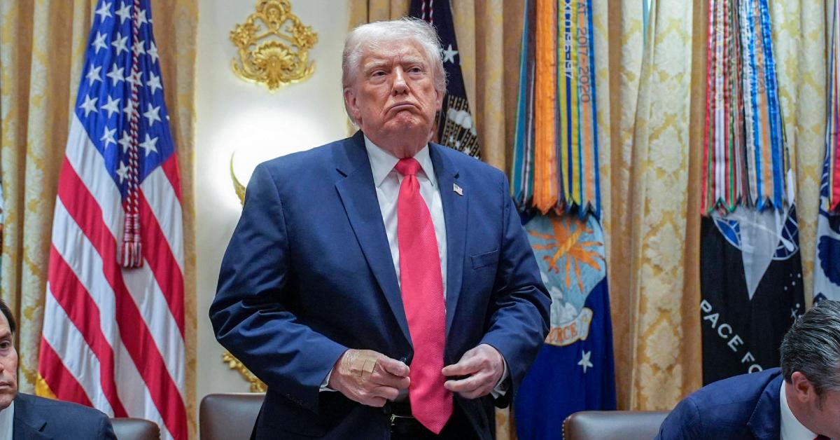 Donald Trump Fuels Health Concerns With Bandages On His Bruised Hand