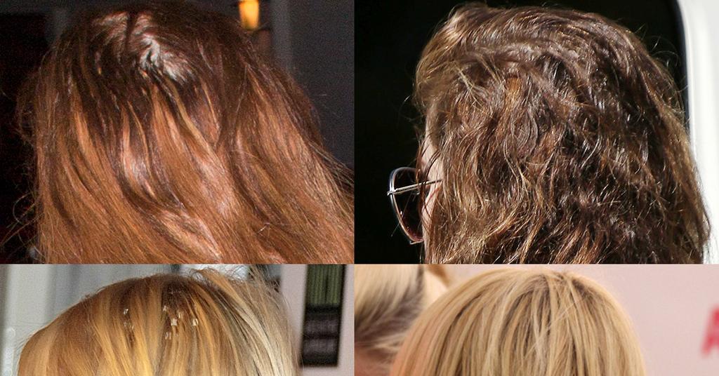 Hair Gone Wrong! 8 Celebrity Hair Extension Fails