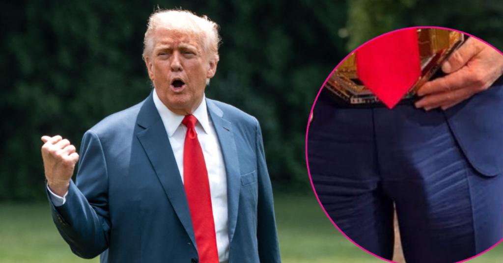 Is Donald Trump Wearing A Catheter? Or Did His Bulge Show At UFC Fight