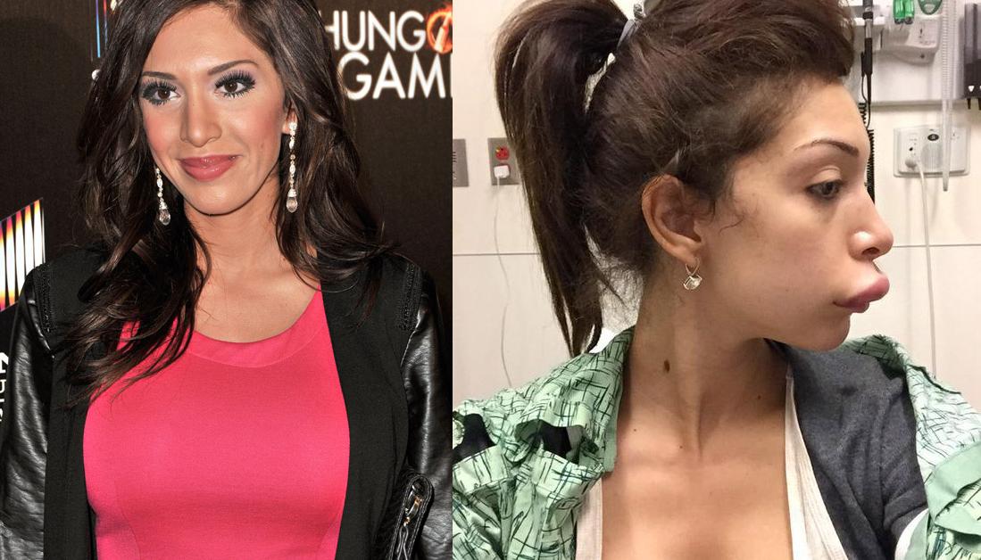 Trout Pout Lips Gone Wrong | Lipstutorial.org