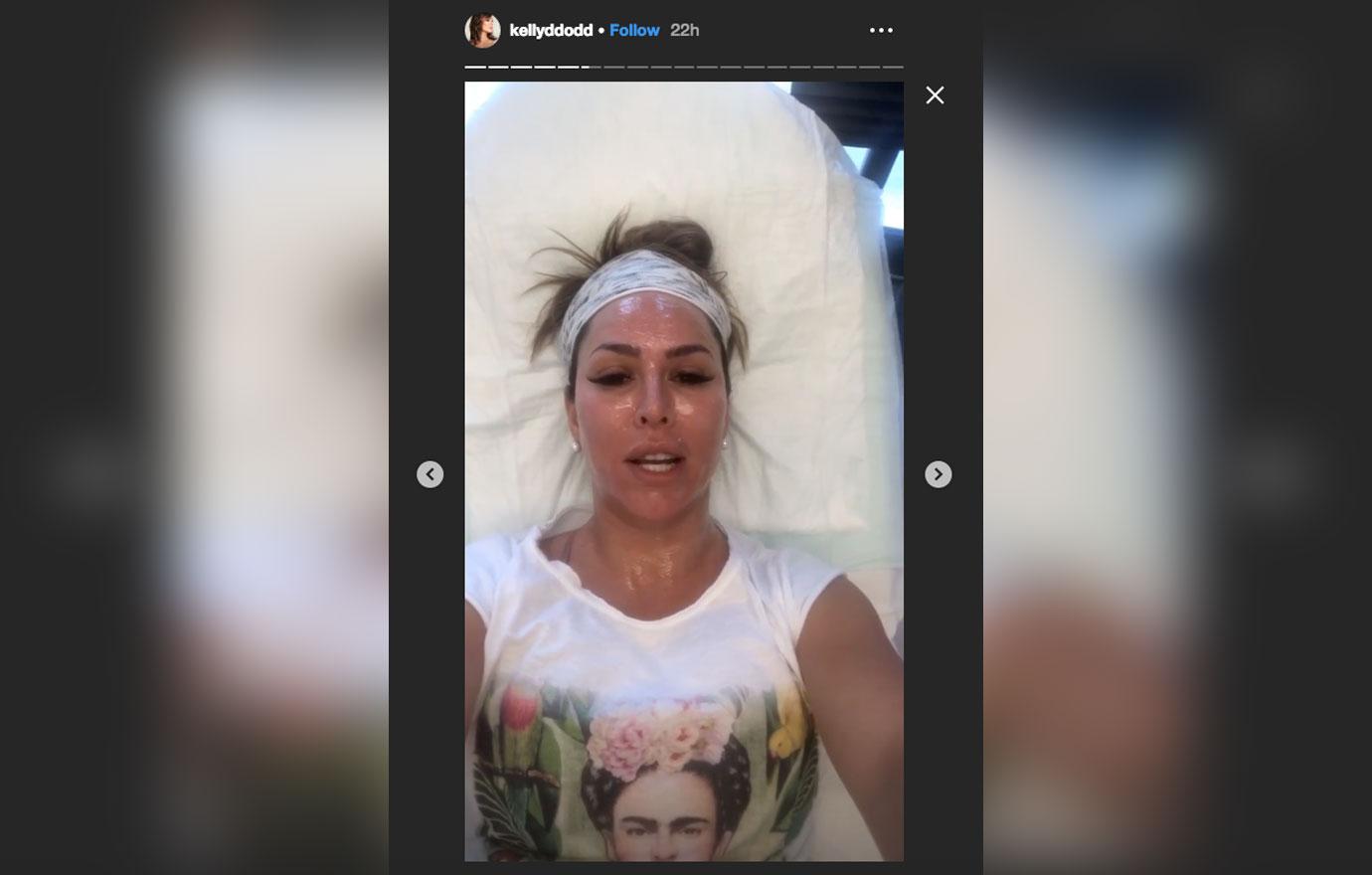 'RHOC’ Star Kelly Dodd Goes In For Another Cosmetic Procedure In ...