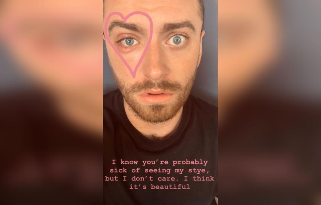 Sam Smith Undergoes Eye Surgery! Get All The Details Here