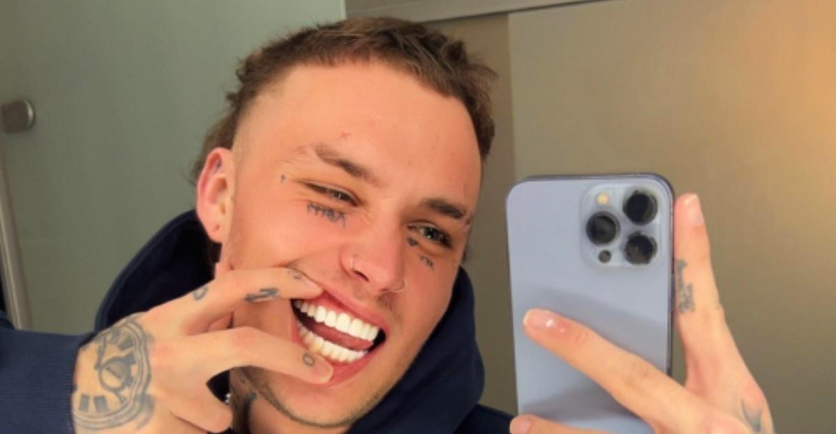 Smile Makeover Magic: How Top Influencers Transform Their Teeth