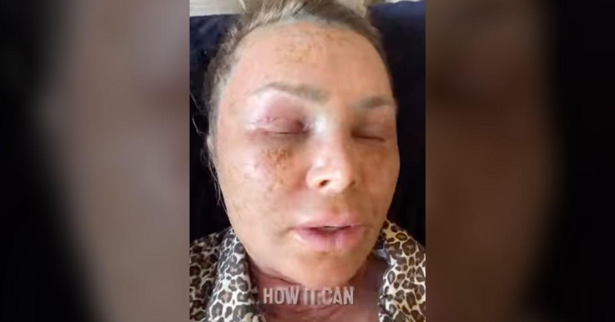 Tamra Judge Looks Unrecognizable After Plastic Surgery Procedure: Pics