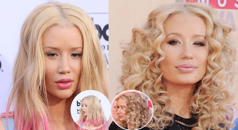 Is That A New Face? Iggy Azalea Sparks More Plastic Surgery Rumors At ...