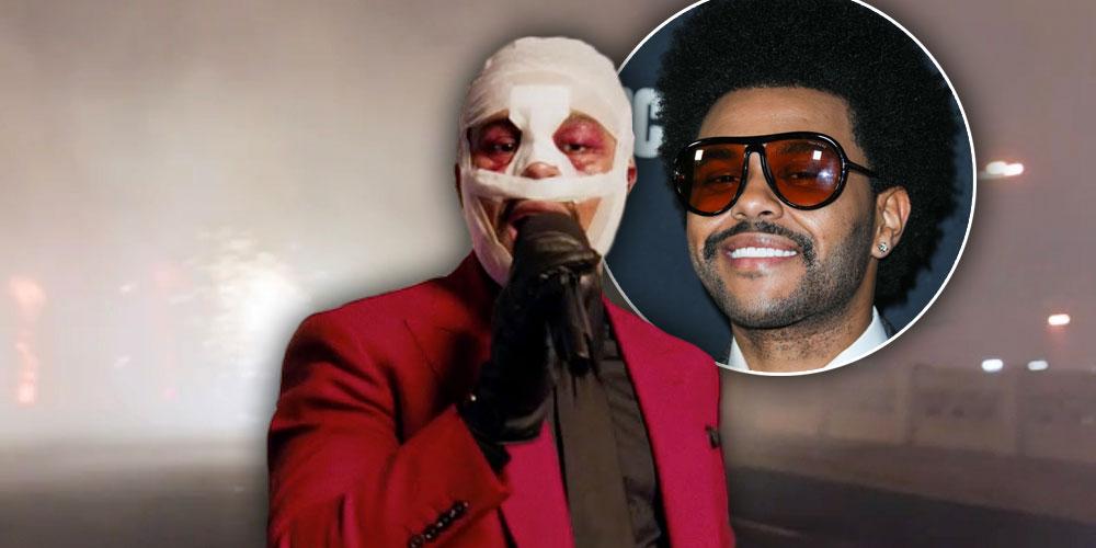 Why Was The Weeknd's Face Bandaged At The AMAs? See Fans React