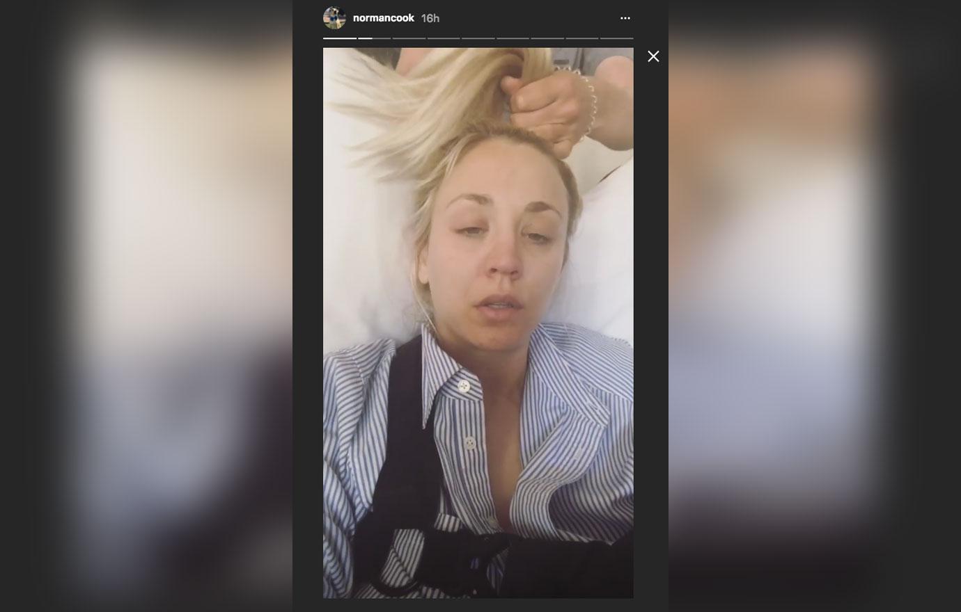 Kaley Cuoco Had Shoulder Surgery Five Days After Getting Married