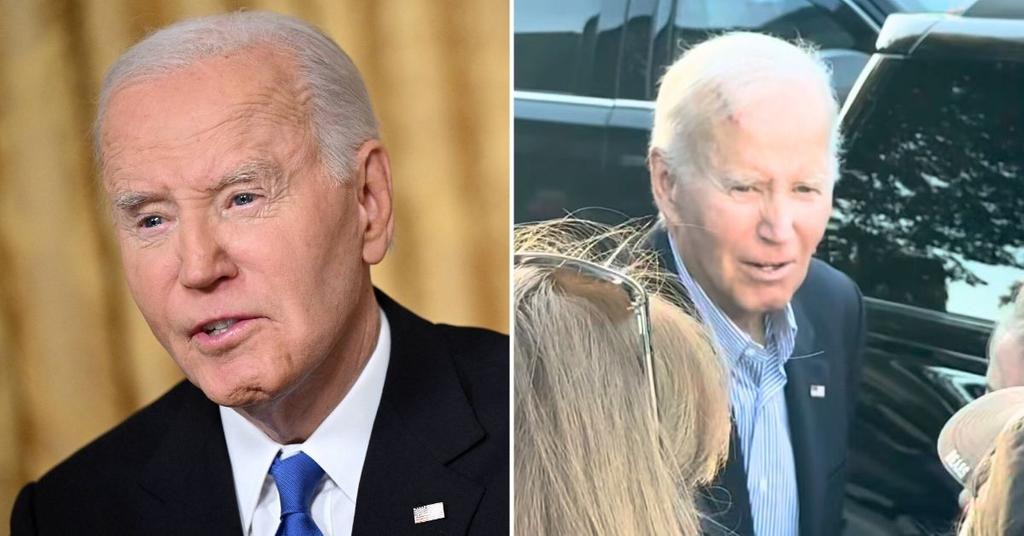 Joe Biden Seen With Gash On His Forehead After Skin Cancer Surgery