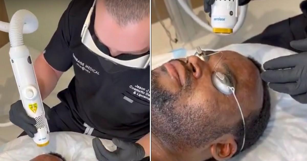 TikTok Star Who Had Bad Chemical Peel Gets It Fixed By Dr. Jason Emer