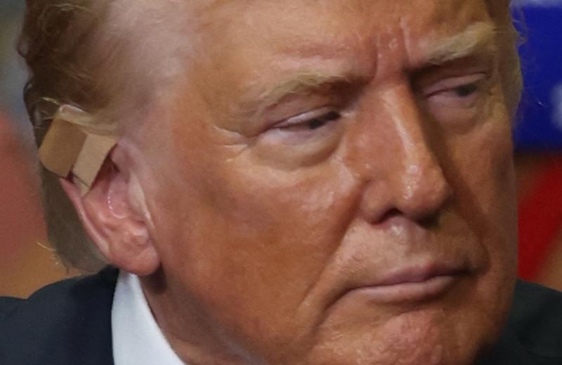 Donald Trump Accused Of Staging Assassination As Ear Shows No Scar