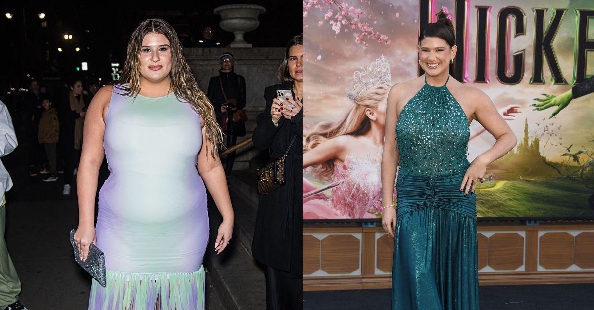 Did Remi Bader Gets Weight Loss Surgery? All About Her Transformation